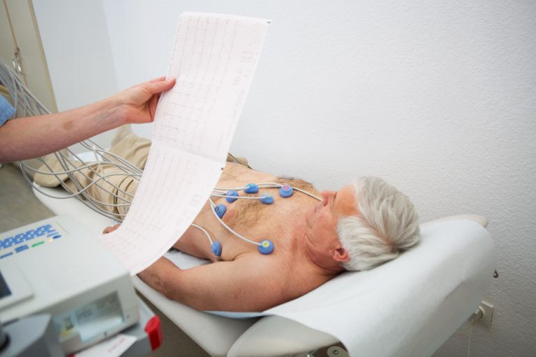 Tests Used to Diagnose Atrial Fibrillation